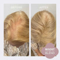 Female Hair Fibres with Applicator Bundle | Boost N Blend – BOOST N ...
